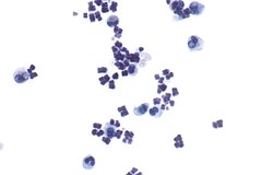 Sarcina - Libre Pathology