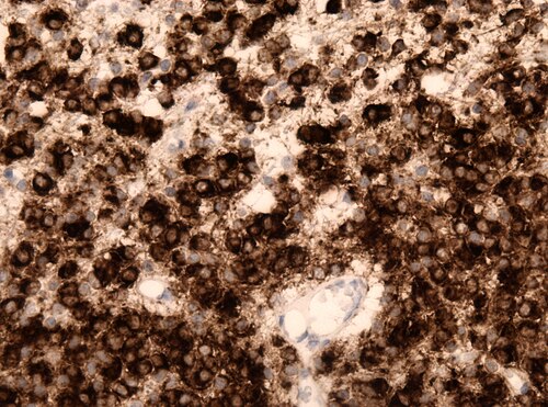 IDH-1 - Libre Pathology