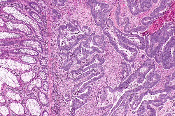 Glands - Libre Pathology