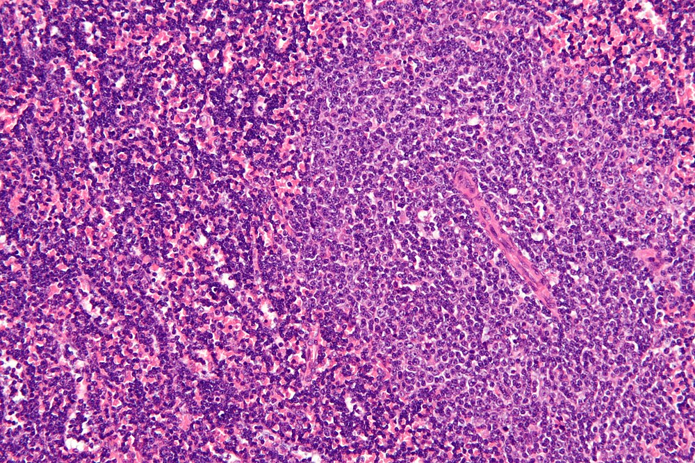 Case 59 - Libre Pathology