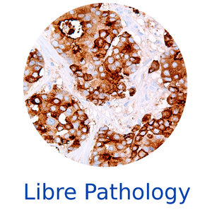 Libre Pathology:ESP/IAP Congress 2016 - Libre Pathology