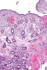 Proliferative phase endometrium - Libre Pathology