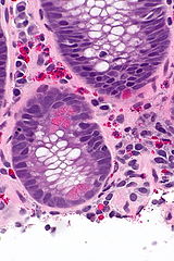 Paneth cell - Libre Pathology