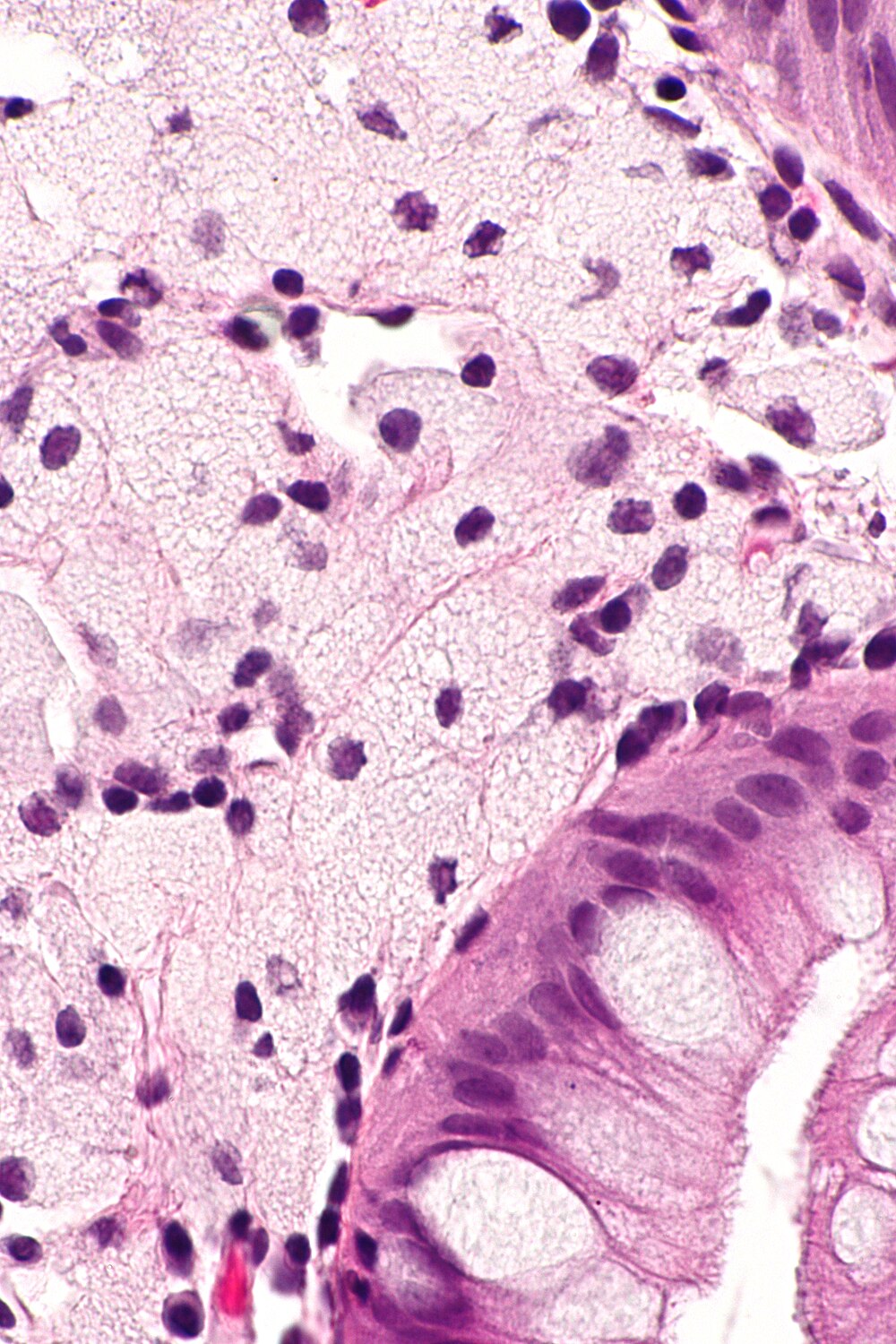 Case 62 - Libre Pathology