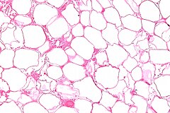 Necrosis - Libre Pathology