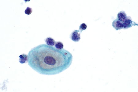 Navicular cell - Libre Pathology