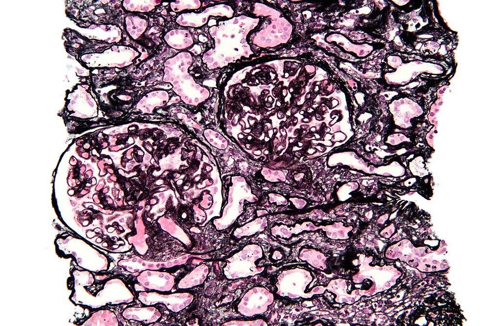 Case 30 - Libre Pathology