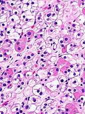 Parathyroid glands - Libre Pathology