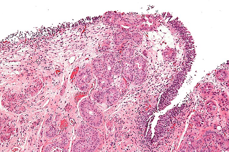 Case 72 - Libre Pathology