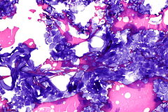 Oxidized cellulose - Libre Pathology