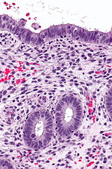 Proliferative phase endometrium - Libre Pathology