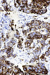 Cytokeratin 20 - Libre Pathology