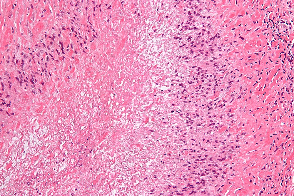 Case 16 - Libre Pathology