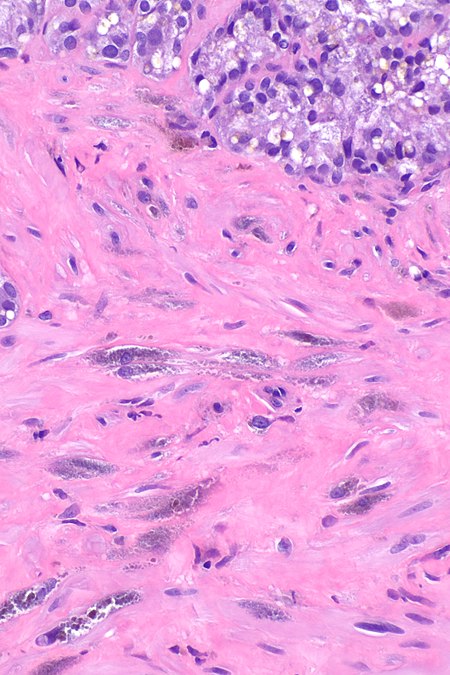 Lipofuscin - Libre Pathology