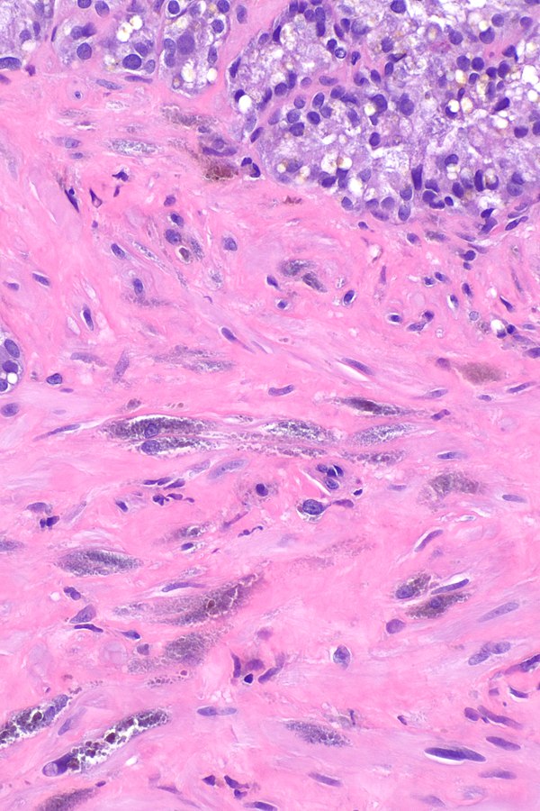 Lipofuscin - Libre Pathology