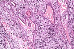 Uterine tubes - Libre Pathology