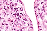 Viruses - Libre Pathology