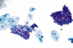 Crystals in body fluids - Libre Pathology