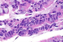 Pulmonary pathology - Libre Pathology