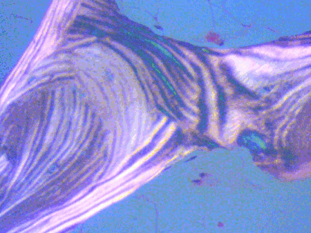 Bone - Libre Pathology