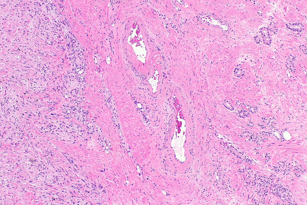 Case 84 - Libre Pathology
