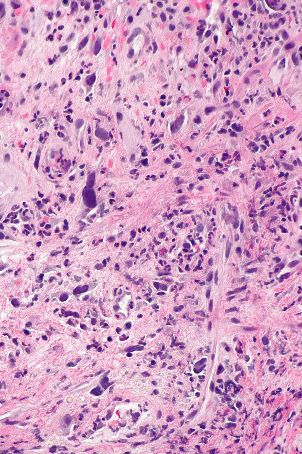 Case 94 - Libre Pathology