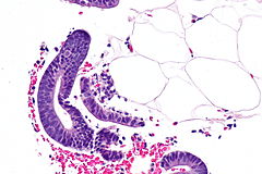 Endometrium - Libre Pathology