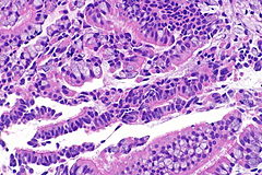 Pulmonary pathology - Libre Pathology