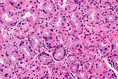 Proton pump inhibitor effect - Libre Pathology