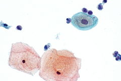 Navicular cell - Libre Pathology