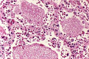 Microorganisms - Libre Pathology