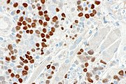 P40 - Libre Pathology