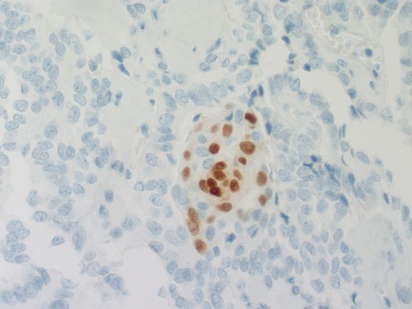 CDX2 - Libre Pathology