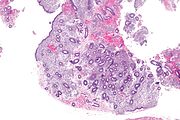 Proliferative phase endometrium - Libre Pathology