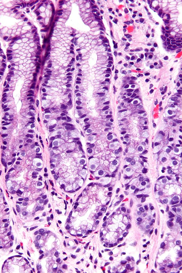 File:G cell hyperplasia - very high mag.jpg - Libre Pathology
