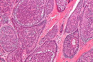Salivary glands - Libre Pathology