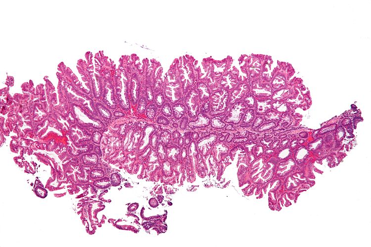 Case 39 - Libre Pathology